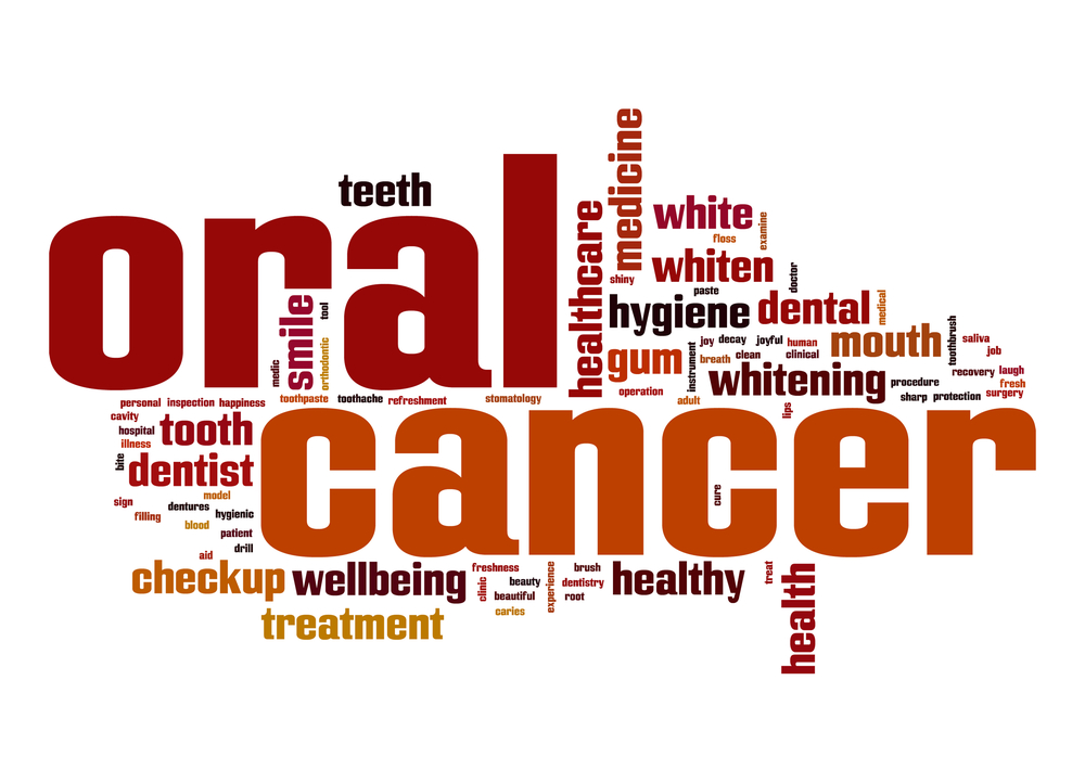 Oral Cancer, Causes, Symptoms, and Treatment | Best Dallas Dentist