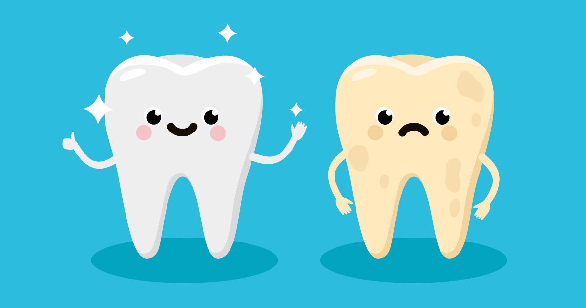 Tooth Discoloration: Causes and Treatment | Dallas Dental Wellness
